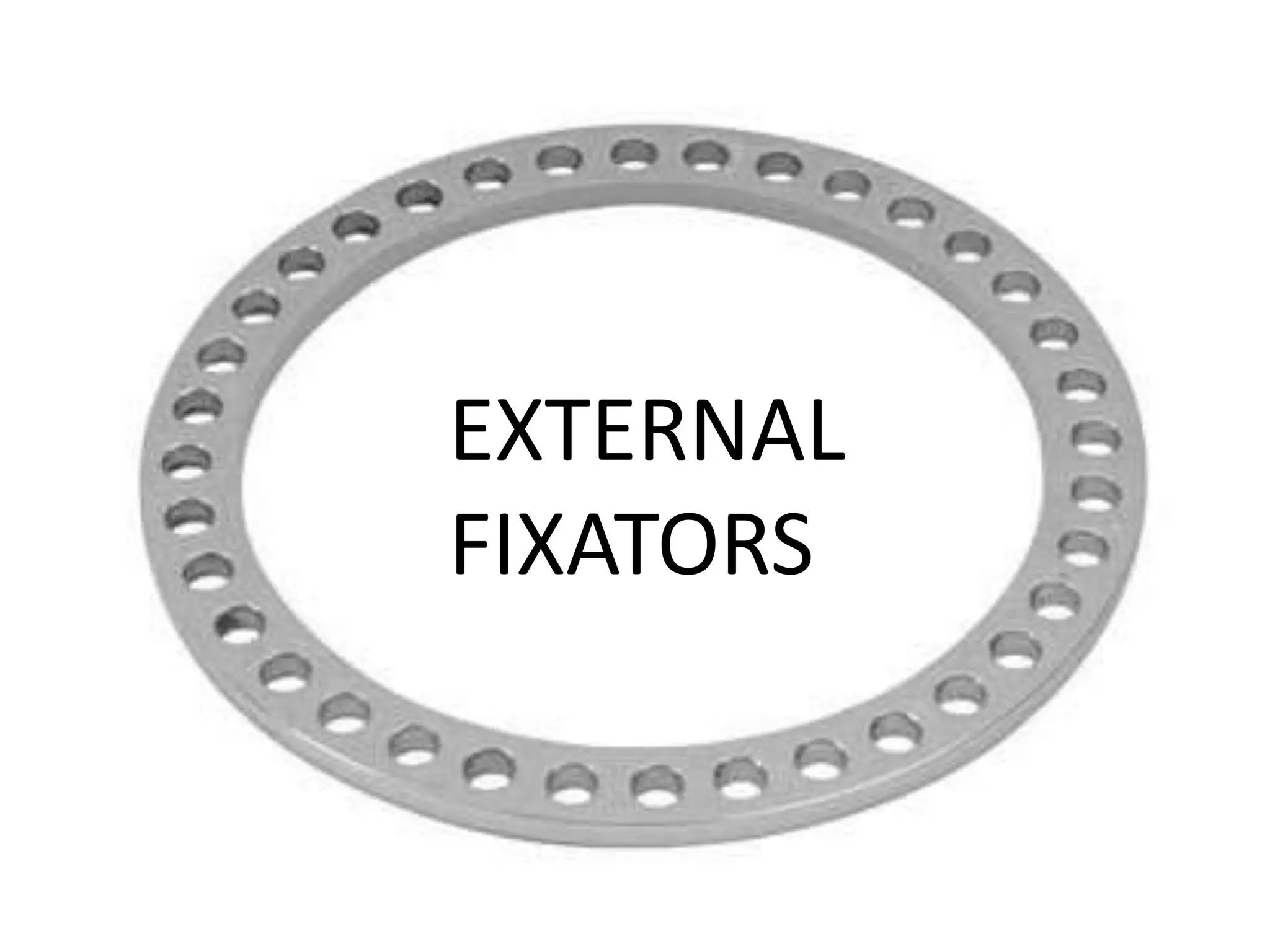 External fixator | PPTX