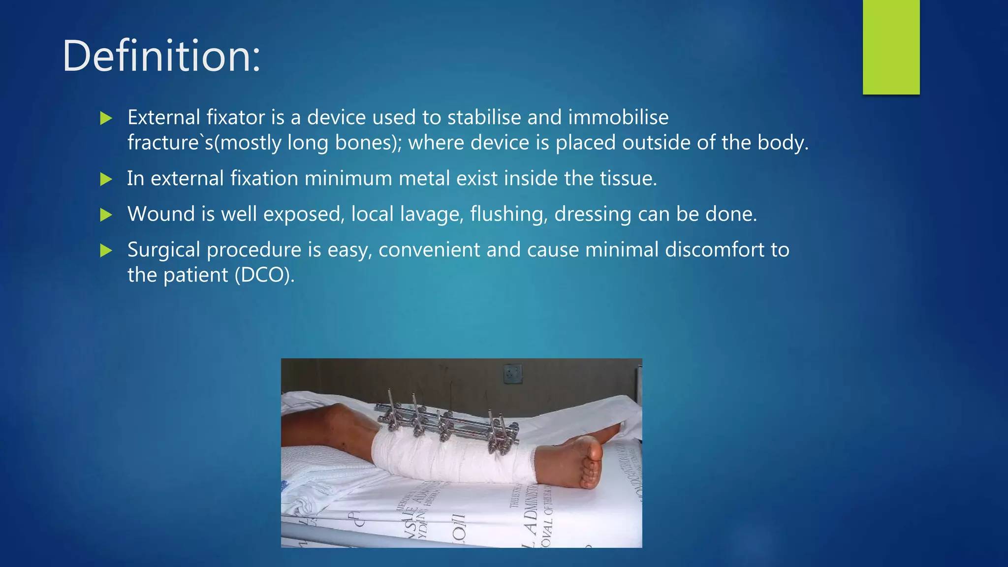 External fixator | PPTX