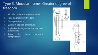 External fixator | PPTX