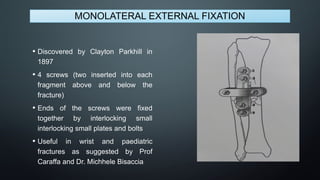 External fixators | PDF