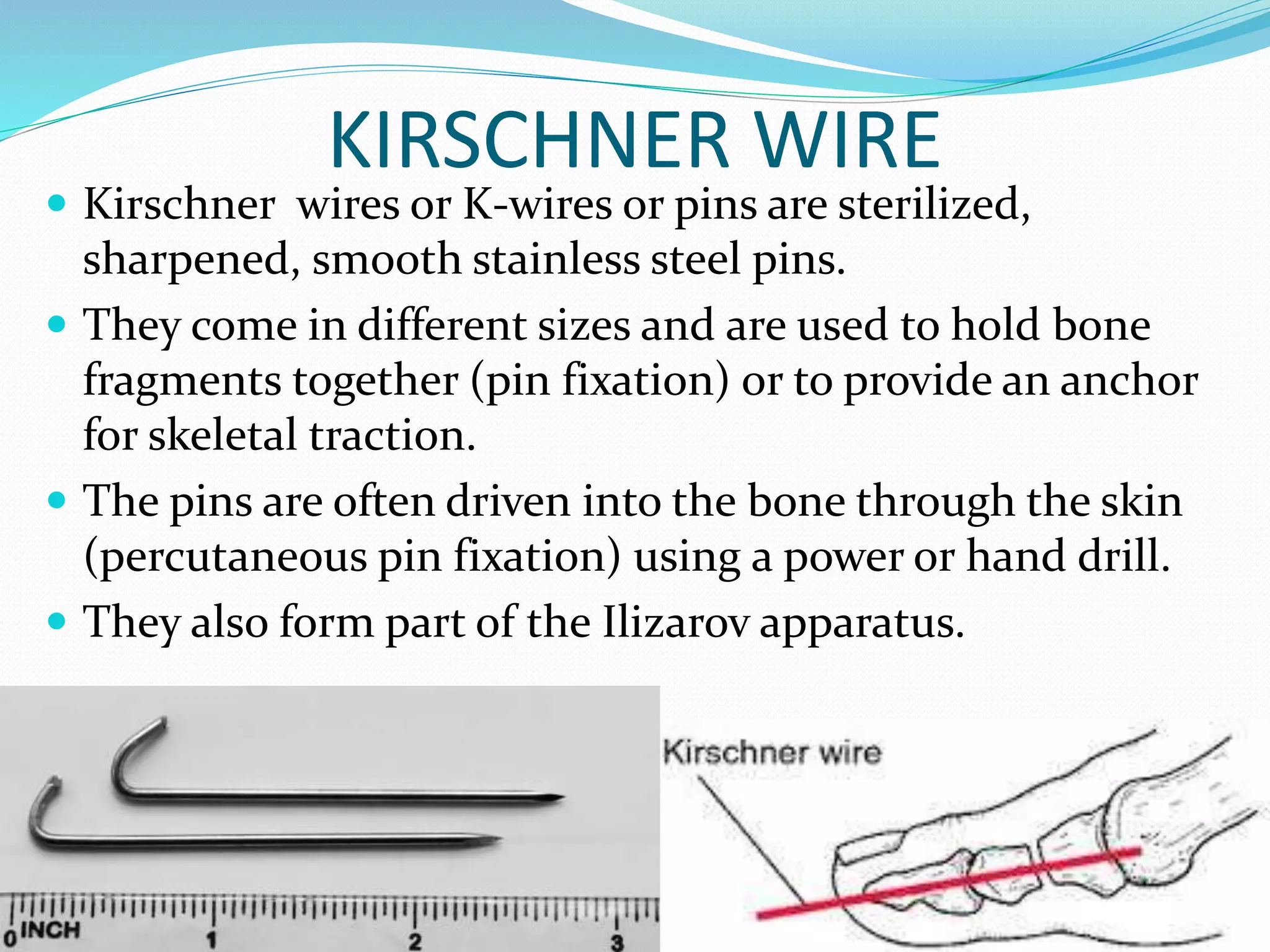 External, internal fixation, DCP and Cast Syndrome | PPTX