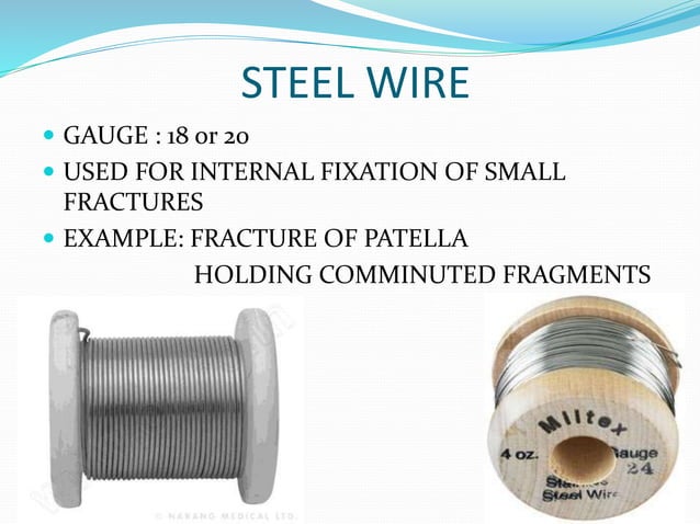 External, internal fixation, DCP and Cast Syndrome | PPTX