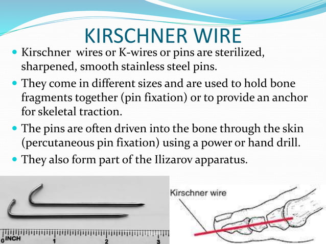 External, internal fixation, DCP and Cast Syndrome | PPTX