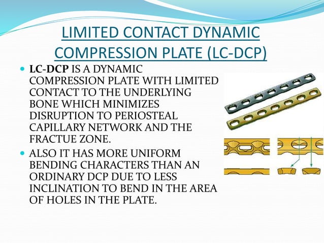 External, internal fixation, DCP and Cast Syndrome | PPTX