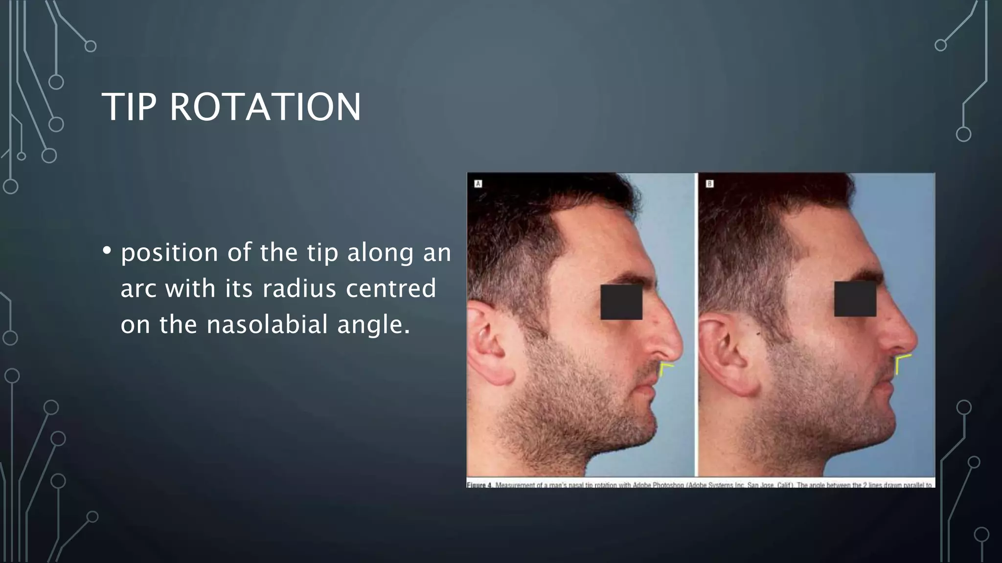 External nasal anatomy | PPTX