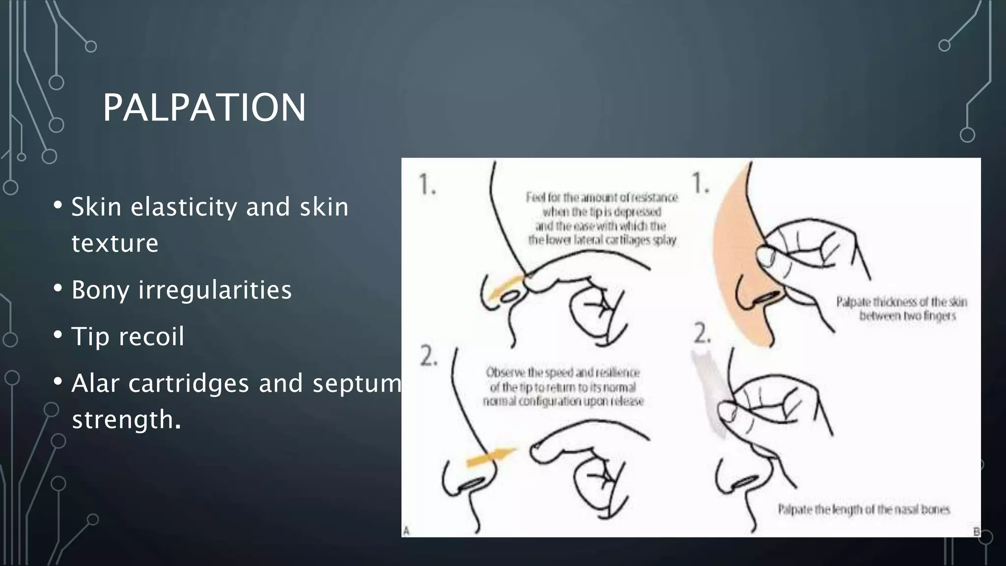 External nasal anatomy | PPTX