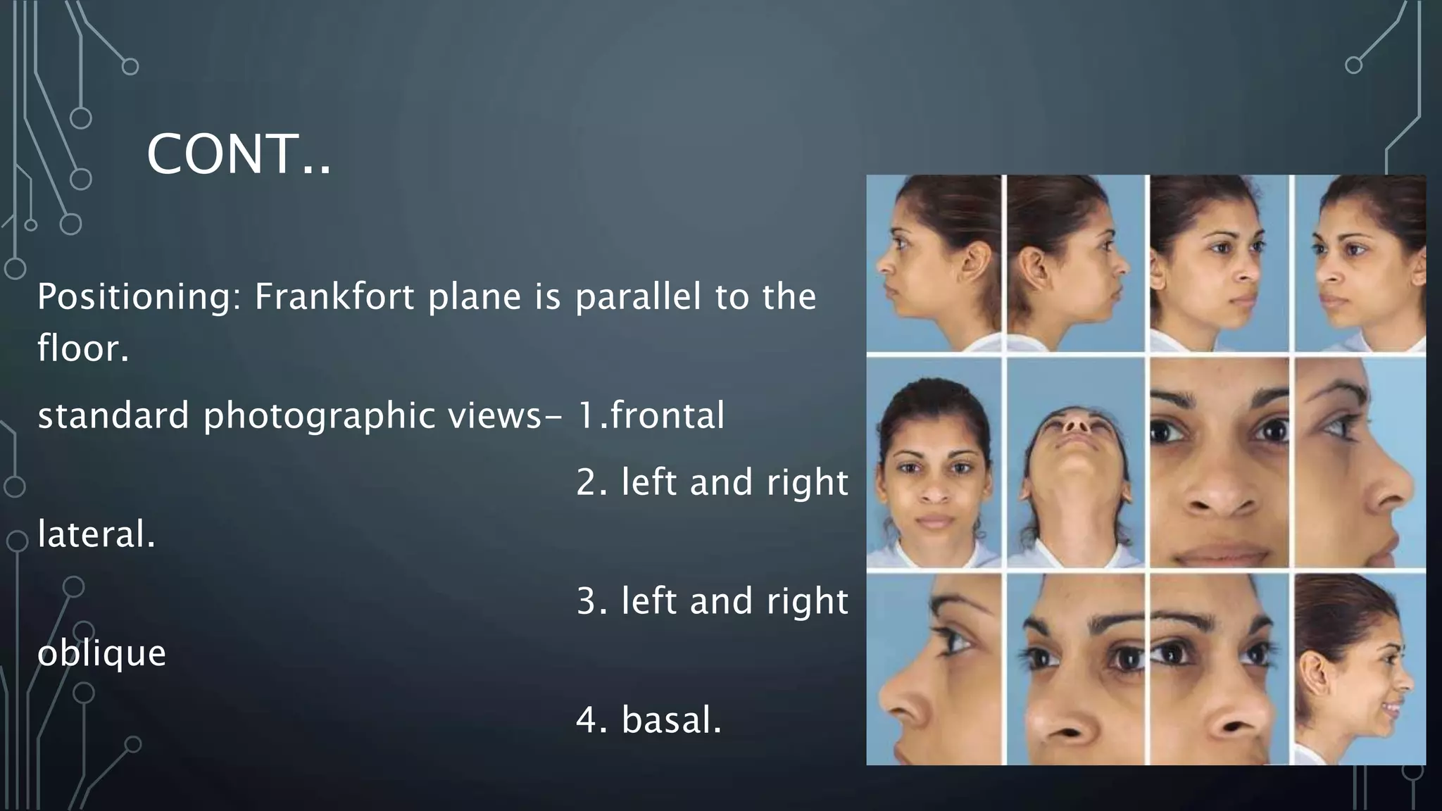 External nasal anatomy | PPTX