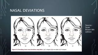 External nasal anatomy | PPTX