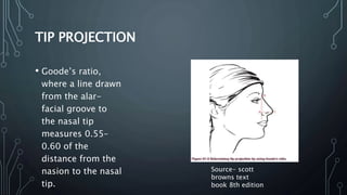 External nasal anatomy | PPTX
