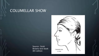 External nasal anatomy | PPTX