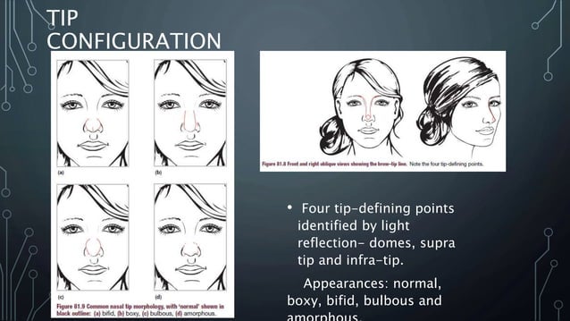 External nasal anatomy | PPTX