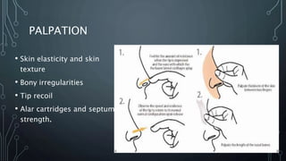 External nasal anatomy | PPTX