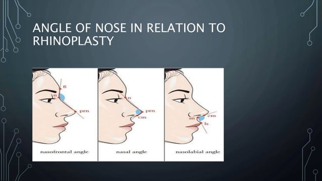 External nasal anatomy | PPTX