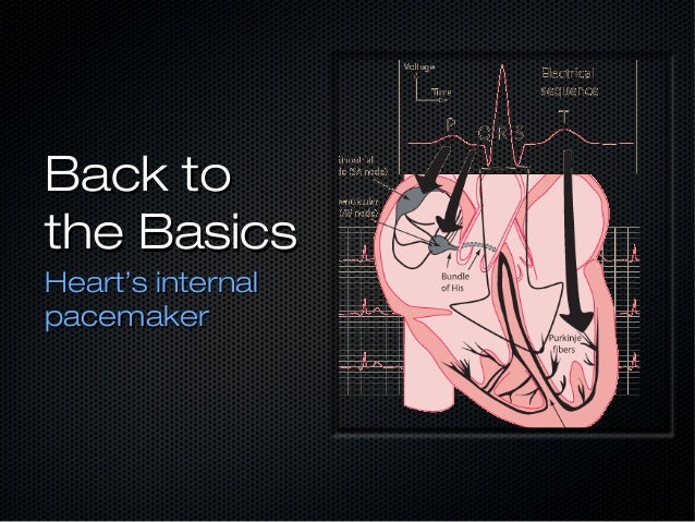 Using External Pacemaker