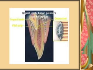 External resorption | PPT