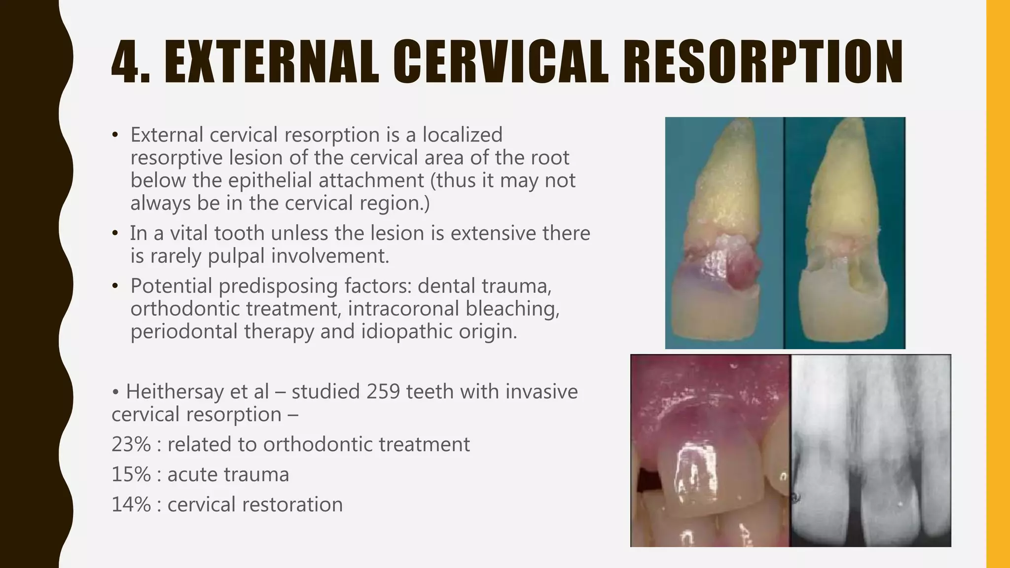 External Root Resorption Err Pptx