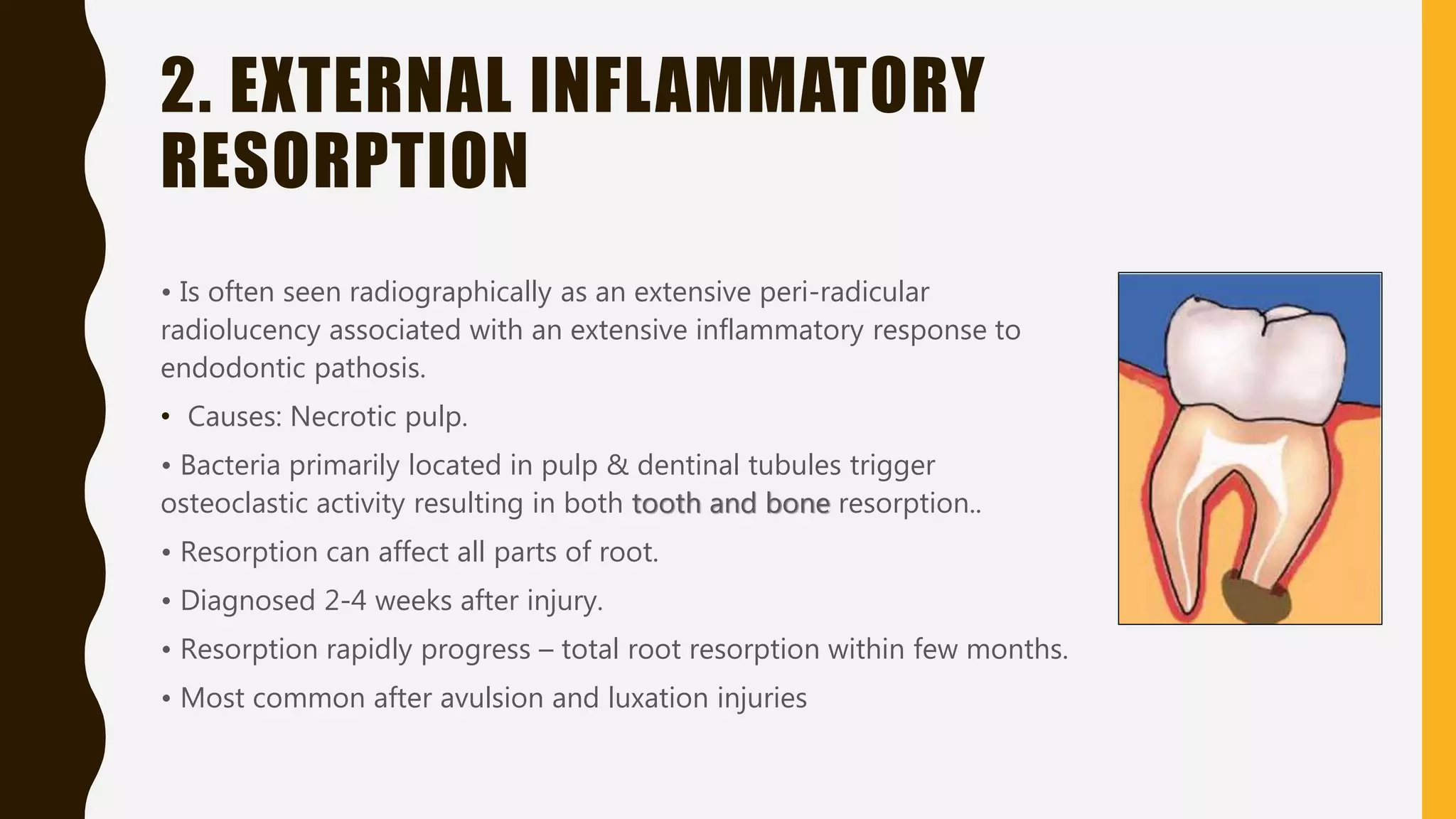 External root resorption (ERR) | PPTX