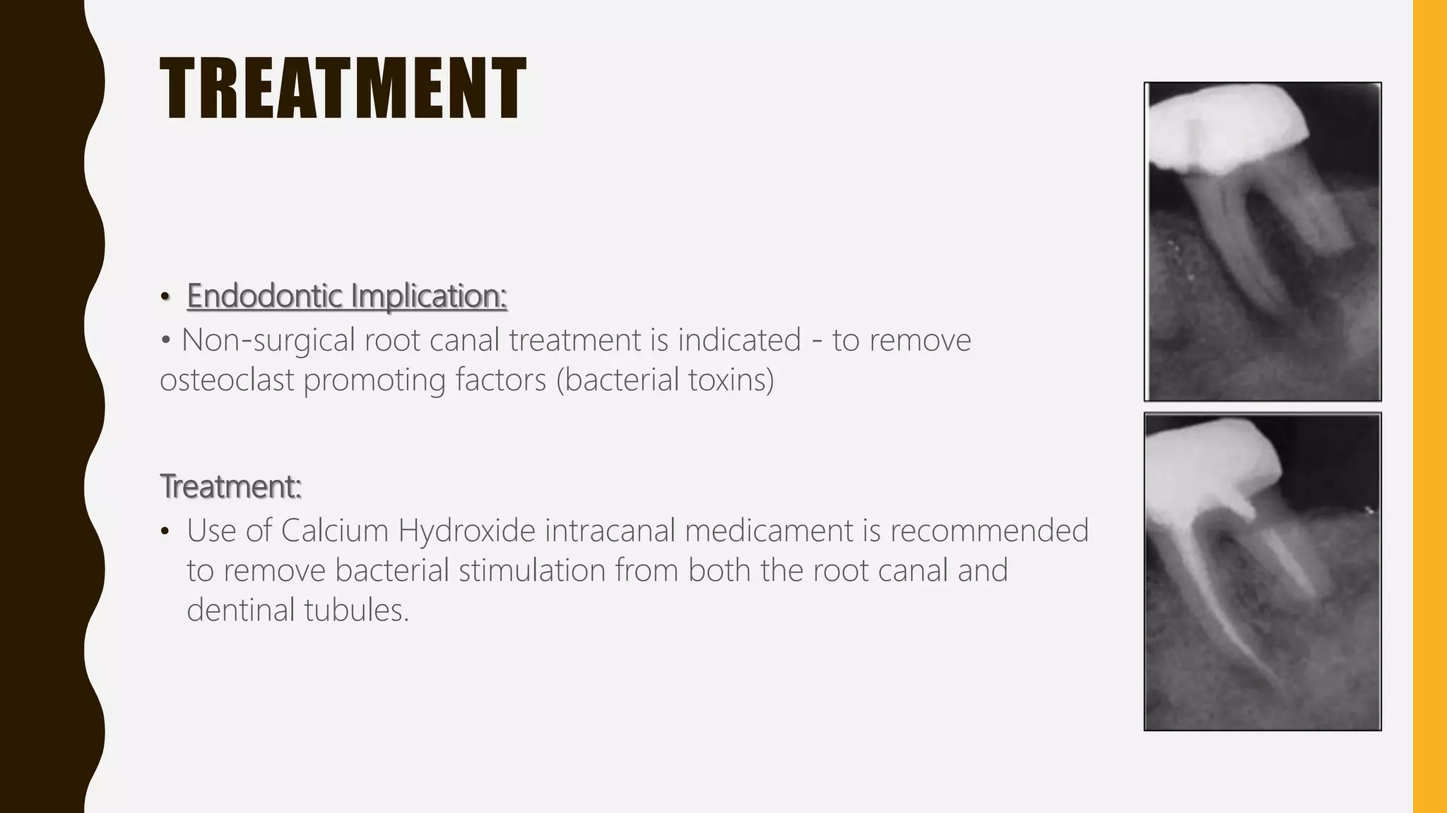 External Root Resorption Err Pptx