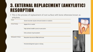 External root resorption (ERR) | PPTX | Dental Health | Diseases and ...