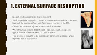 External root resorption (ERR) | PPTX