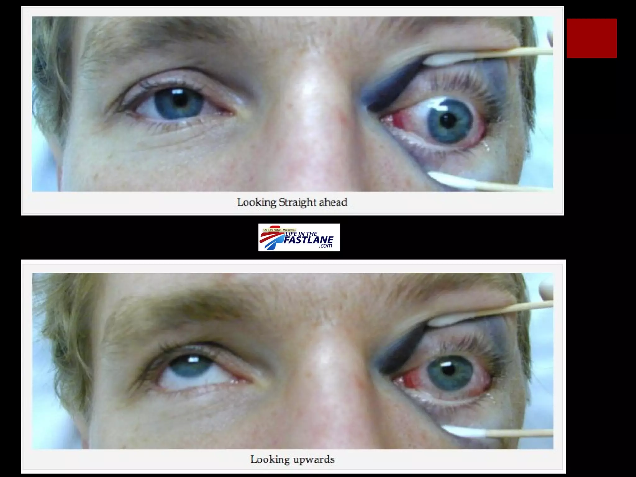 External signs of internal injuries tfinal | PPT