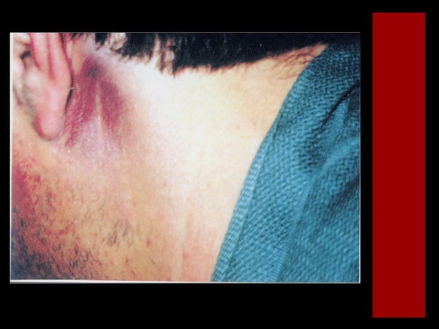 External signs of internal injuries tfinal | PPT