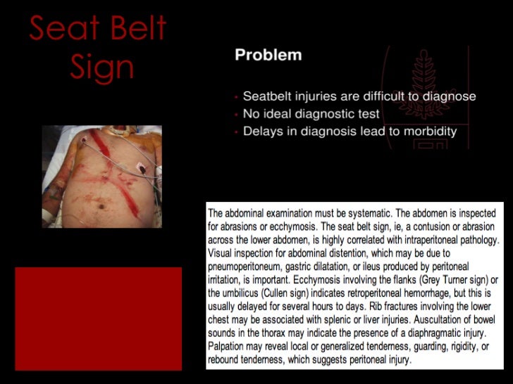 External signs of internal injuries tfinal