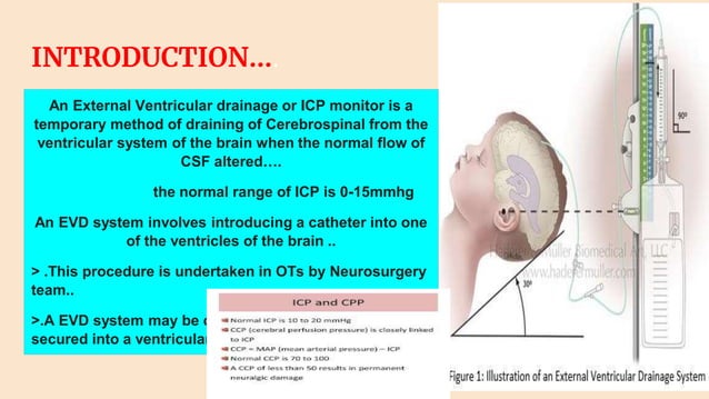 EXTERNAL VENTRICULAR CARE FOR NURSES.pptx