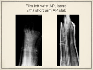 Extern conference.thitirat | PPTX