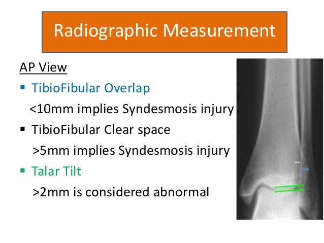 Extern conference Ankle Fracture JOE