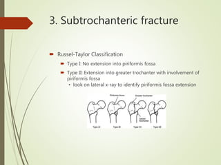 Extern conference 50859 | PPT
