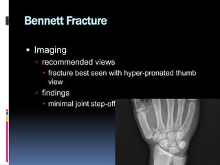 Rolando Vs Bennett Fracture