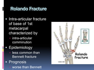 Rolando Fracture | PPTX