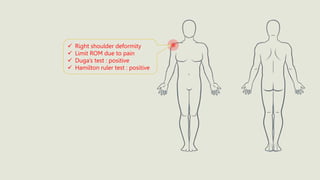 Extern conference orthopedics Ext.กิตตินันทน์ 12 กพ.61