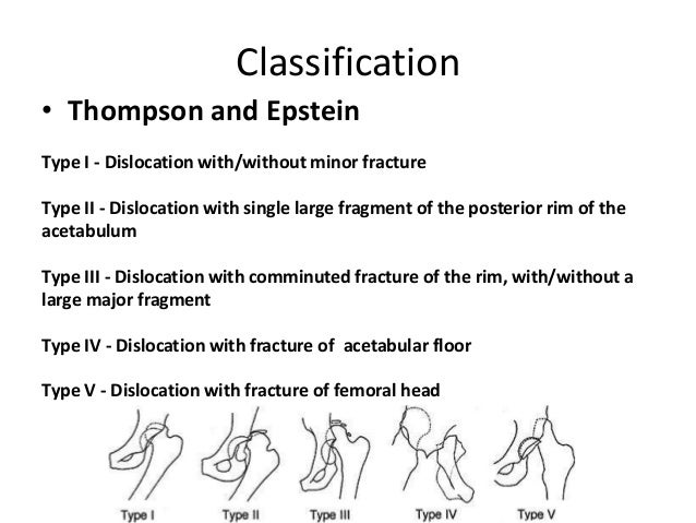 Extern conference praparat
