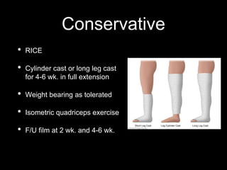 Cylinder Cast Patella