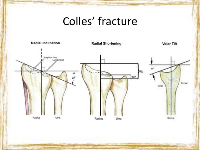 Extern orthopedics conference