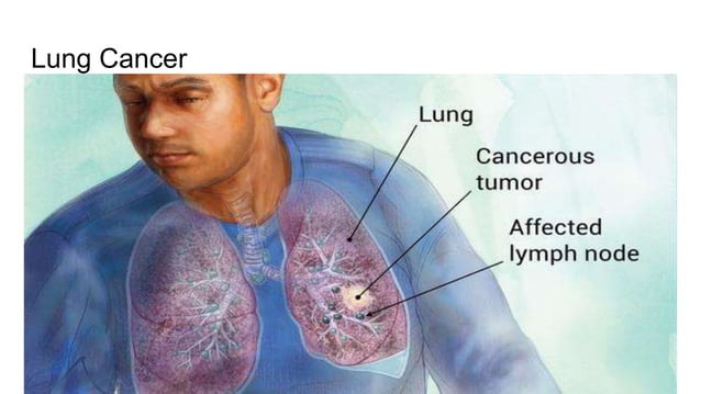 Cancer Biology: an overview | PPTX