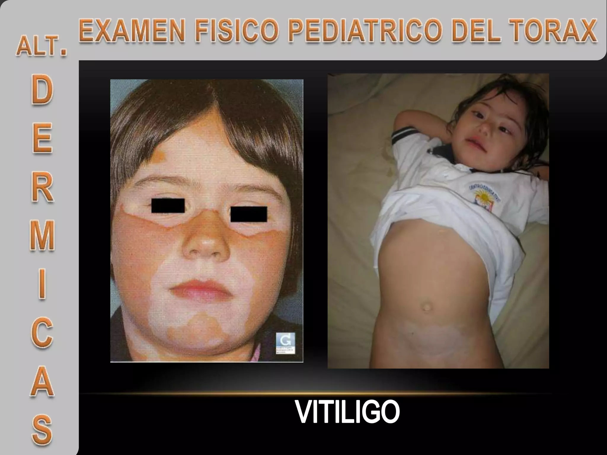 Examen Torax Pediatrico Inspeccion y Palpacion | PPT | Free Download