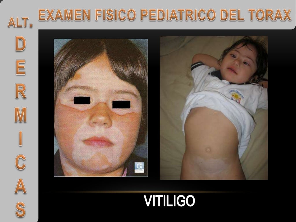 Examen Torax Pediatrico Inspeccion y Palpacion