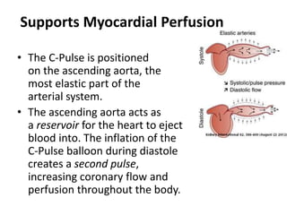 Extra aortic balloon counterpulsation | PPT