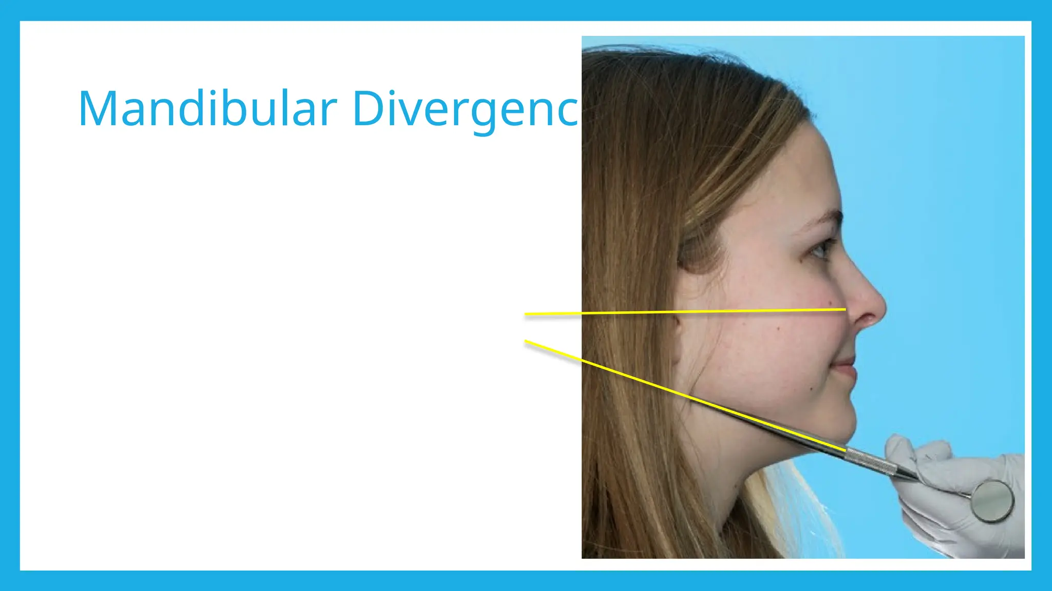 Extra-oral examination in orthodontics - A guide for students | PPTX