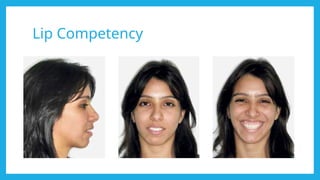 Extra-oral examination in orthodontics - A guide for students | PPTX