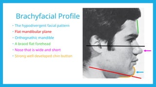 Extra-oral examination in orthodontics - A guide for students | PPTX