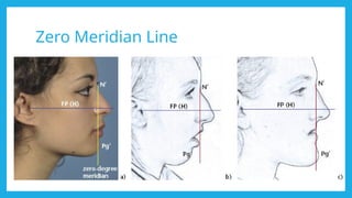 Extra-oral examination in orthodontics - A guide for students | PPTX