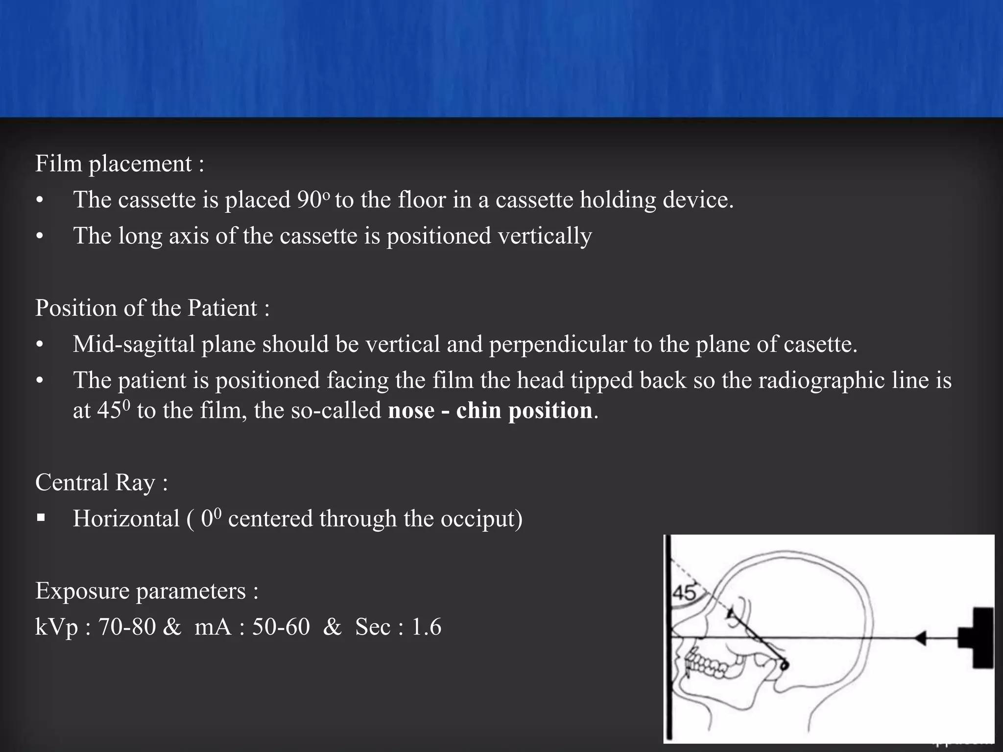 Extra oral radiographic techniques | PPTX