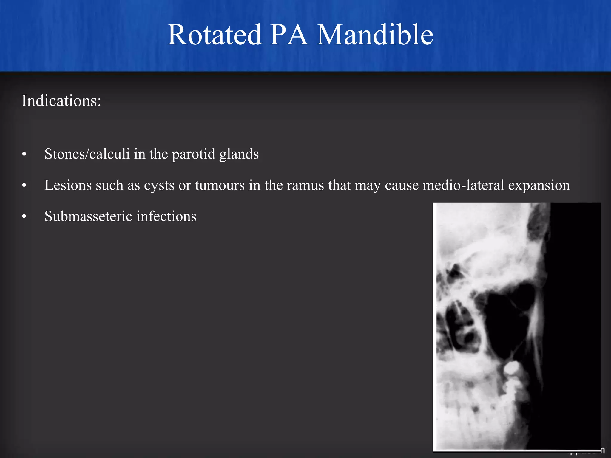 Extra oral radiographic techniques | PPTX