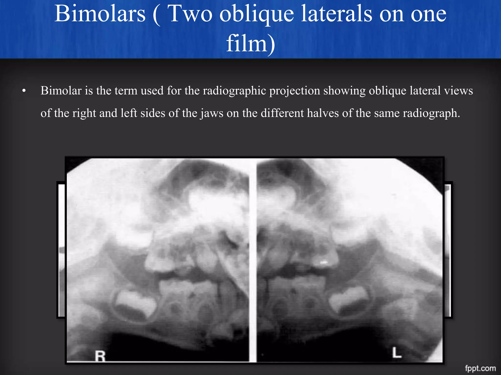 Extra oral radiographic techniques | PPTX