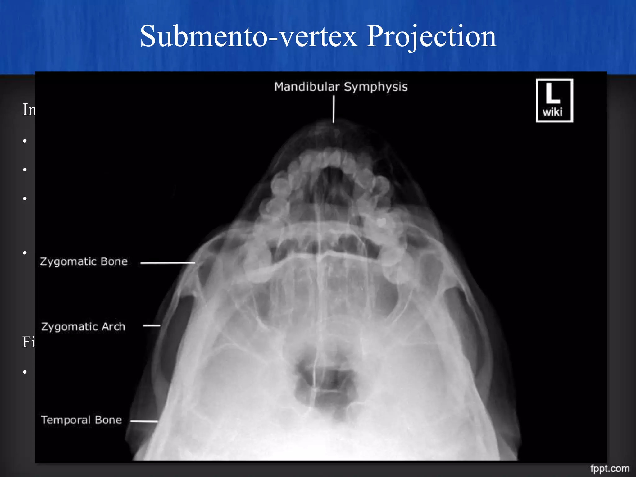 Extra oral radiographic techniques | PPTX