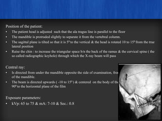 Extra oral radiographic techniques | PPTX